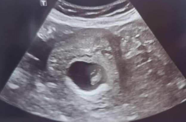 Ramzi Theory: Predict Baby's Gender Early
